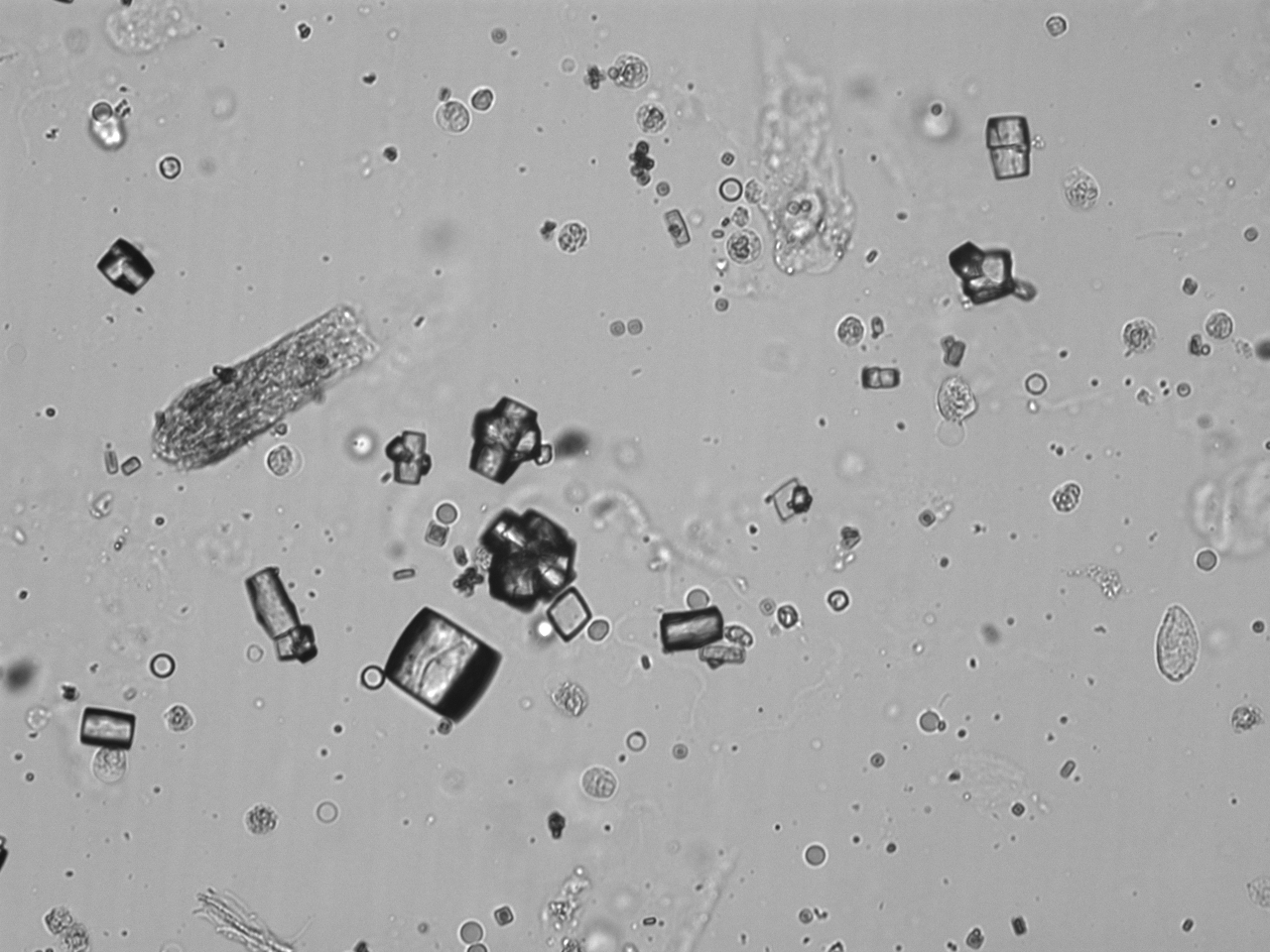 Uric acid - Cylinder | CellWiki