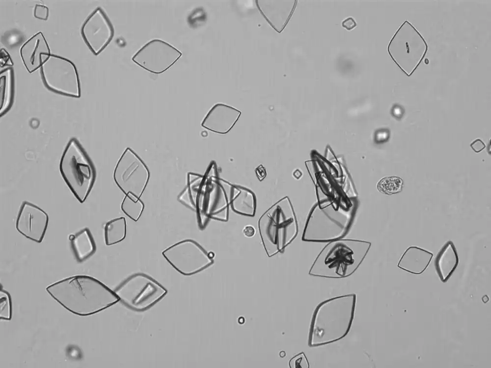 Uric acid - Diamond | CellWiki