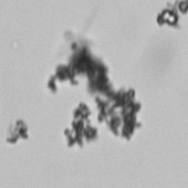 Amorphous precipitation | CellWiki