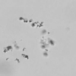 Amorphous precipitation | CellWiki