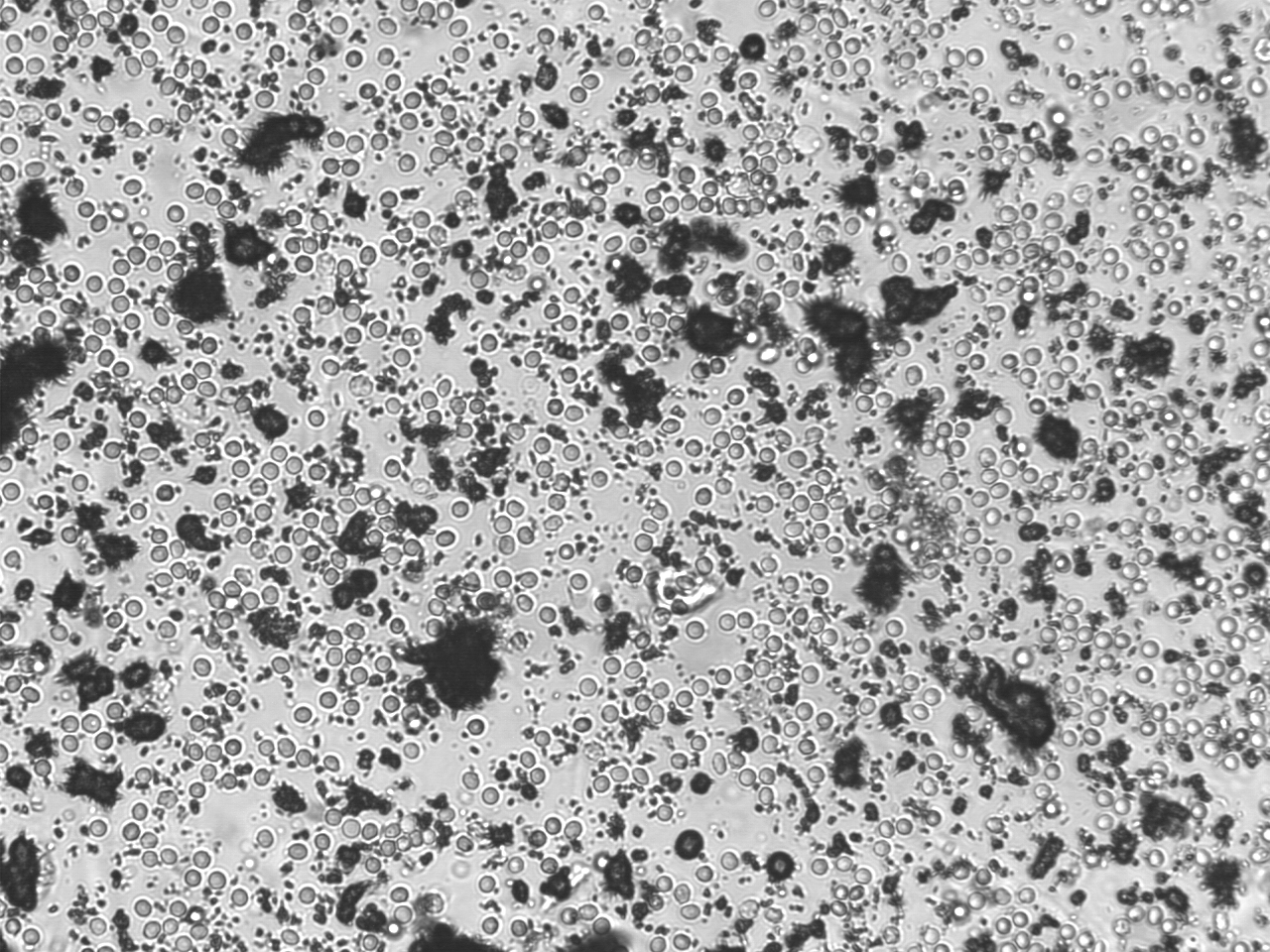 Ammonium urate - Spikes | CellWiki