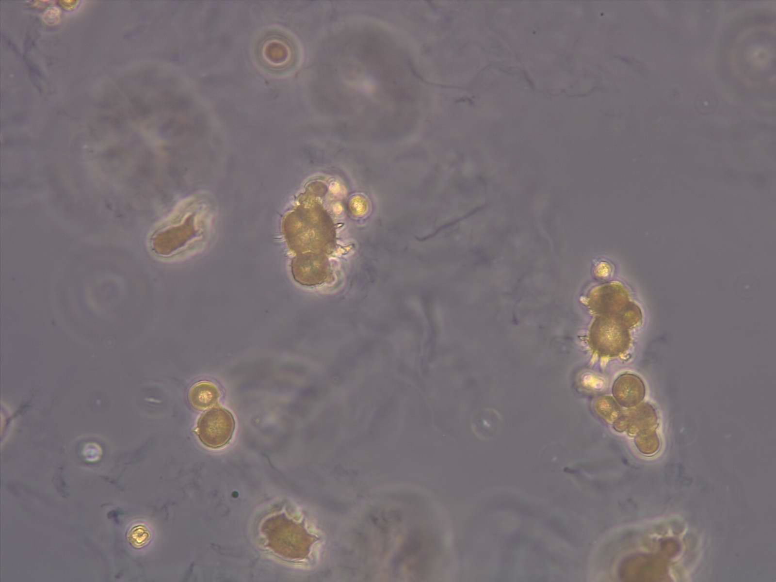Ammonium urate - Spikes | CellWiki