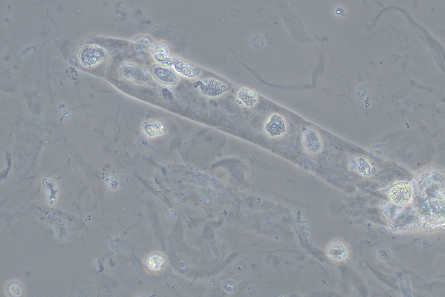 Leukocyte cast | CellWiki