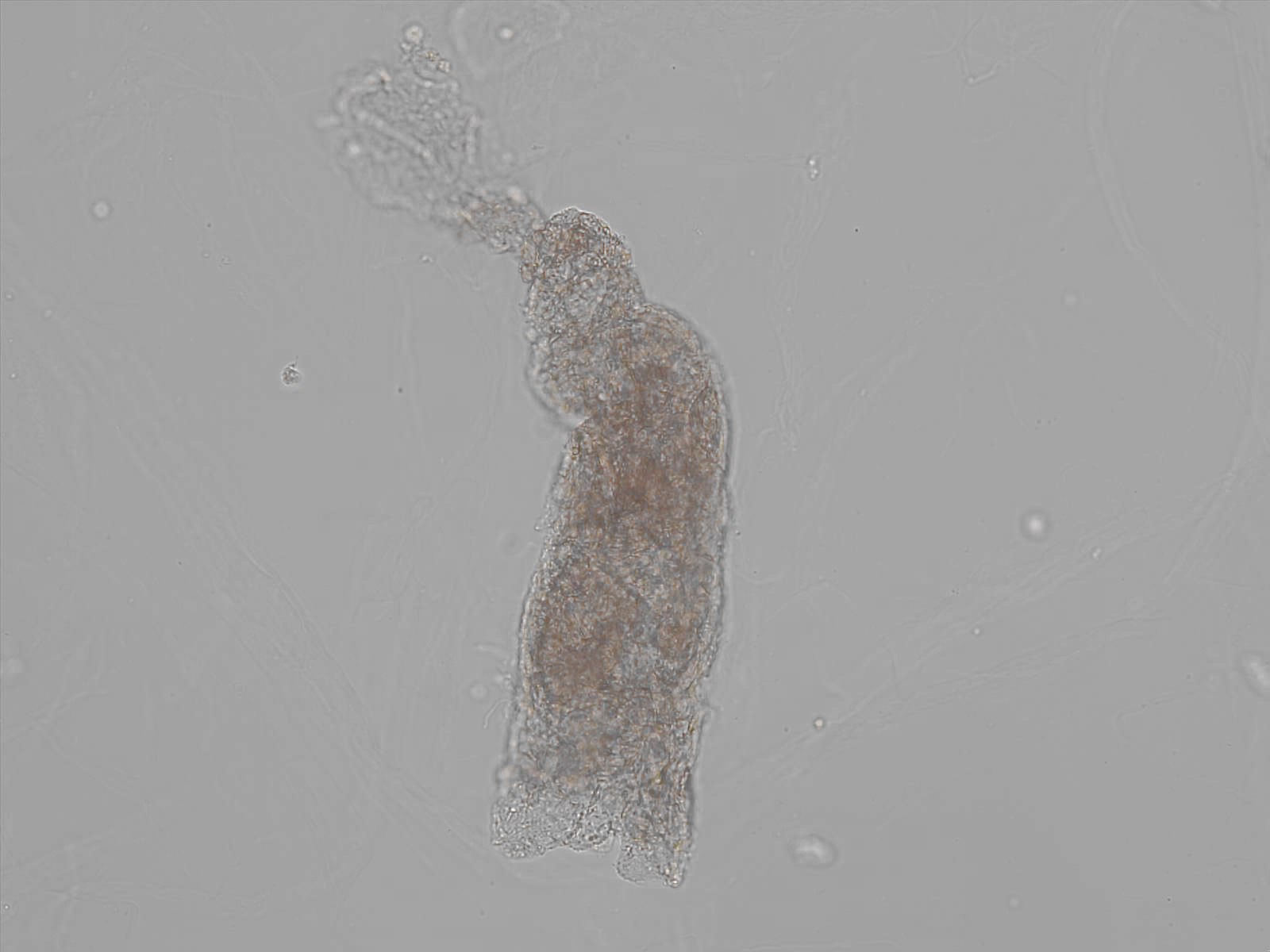 Granular cast | CellWiki