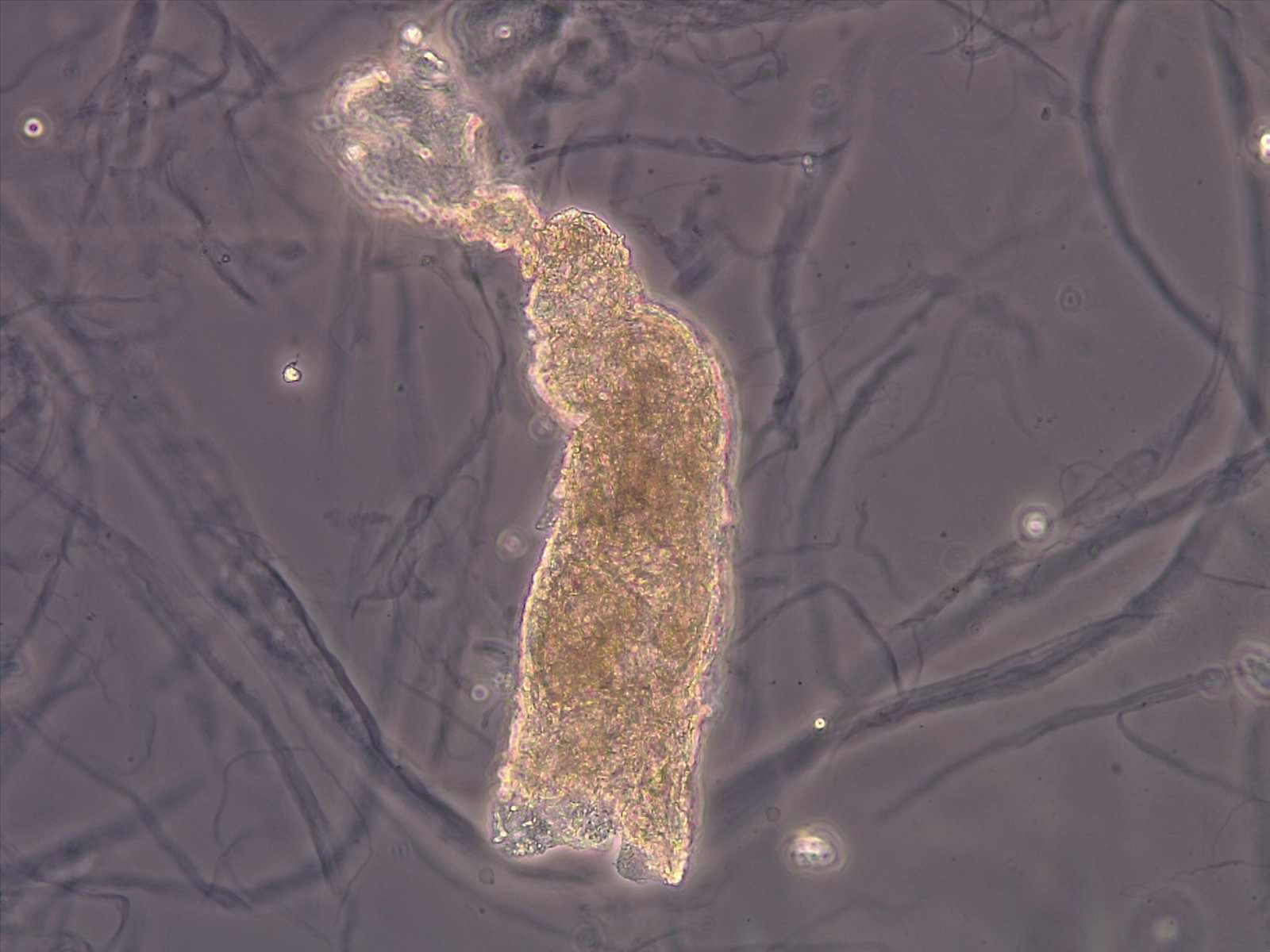 Granular cast | CellWiki