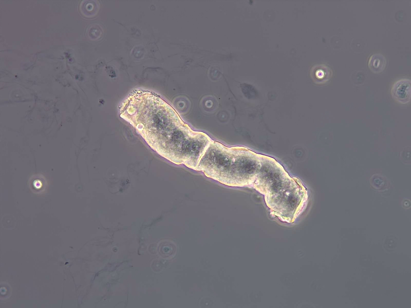 Waxy cast | CellWiki