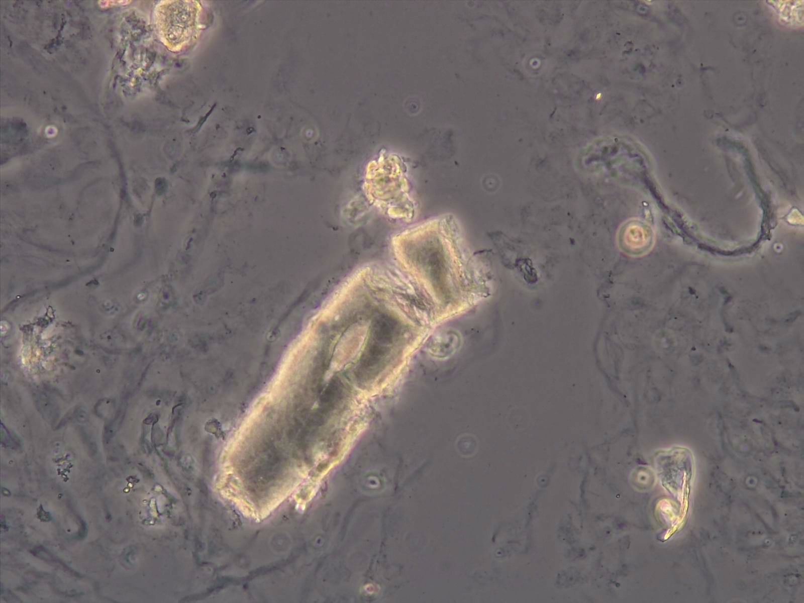 Waxy cast | CellWiki