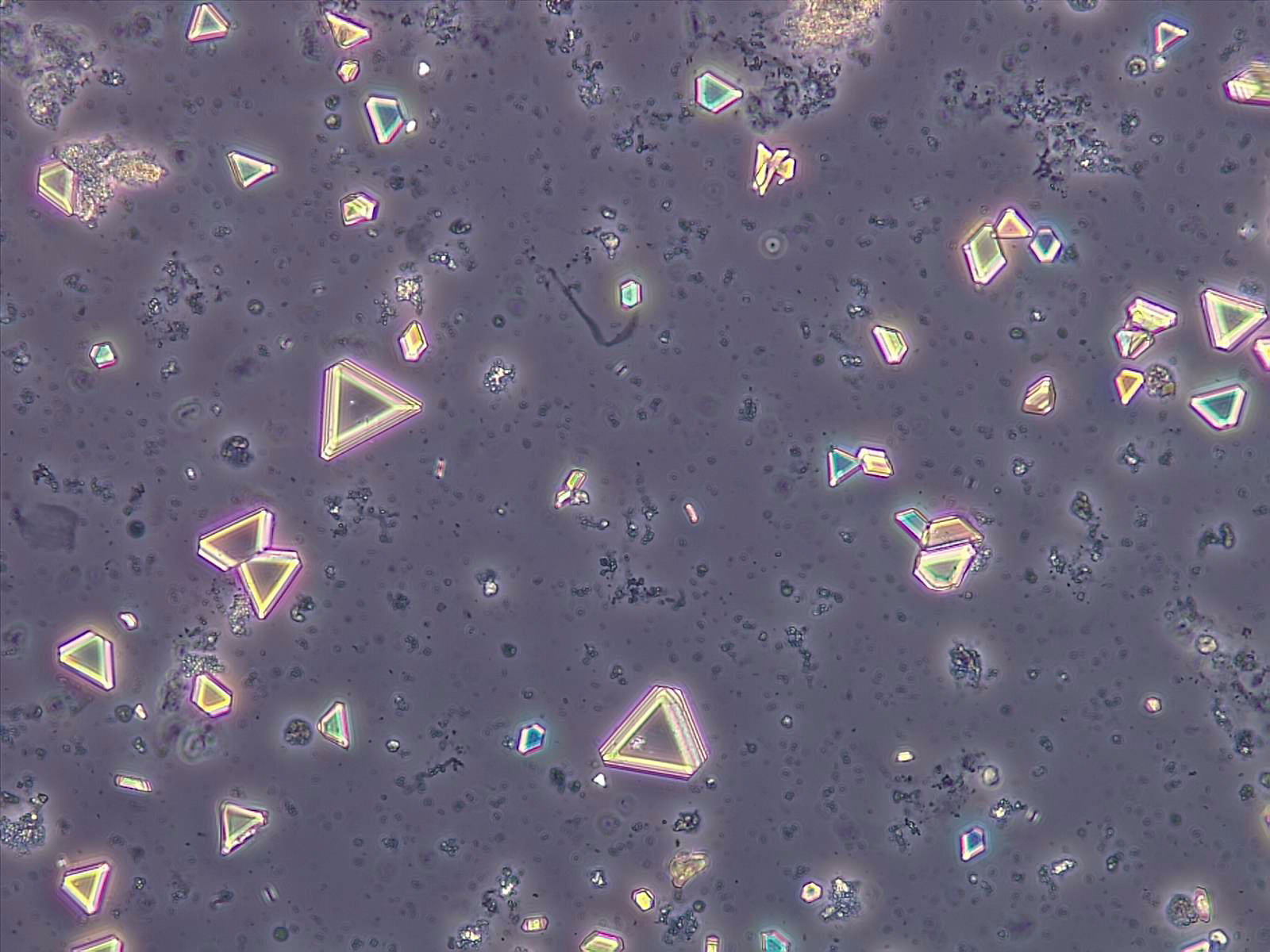 Triple phosphate - Triangle | CellWiki