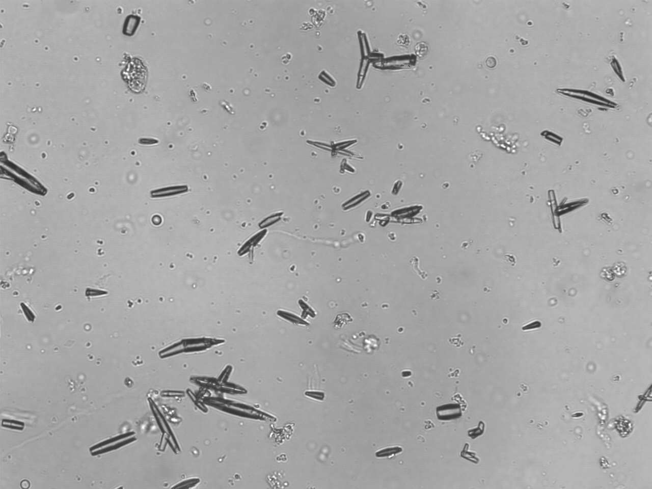 Uric acid - Bullet form | CellWiki