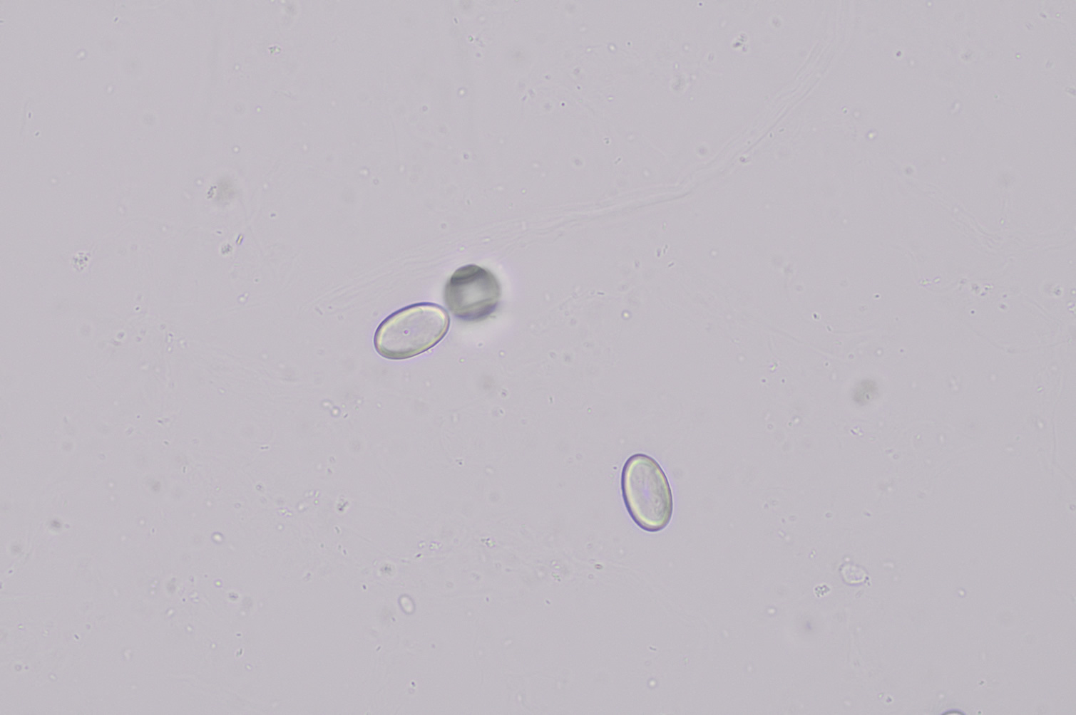 CaOx - Oval | CellWiki